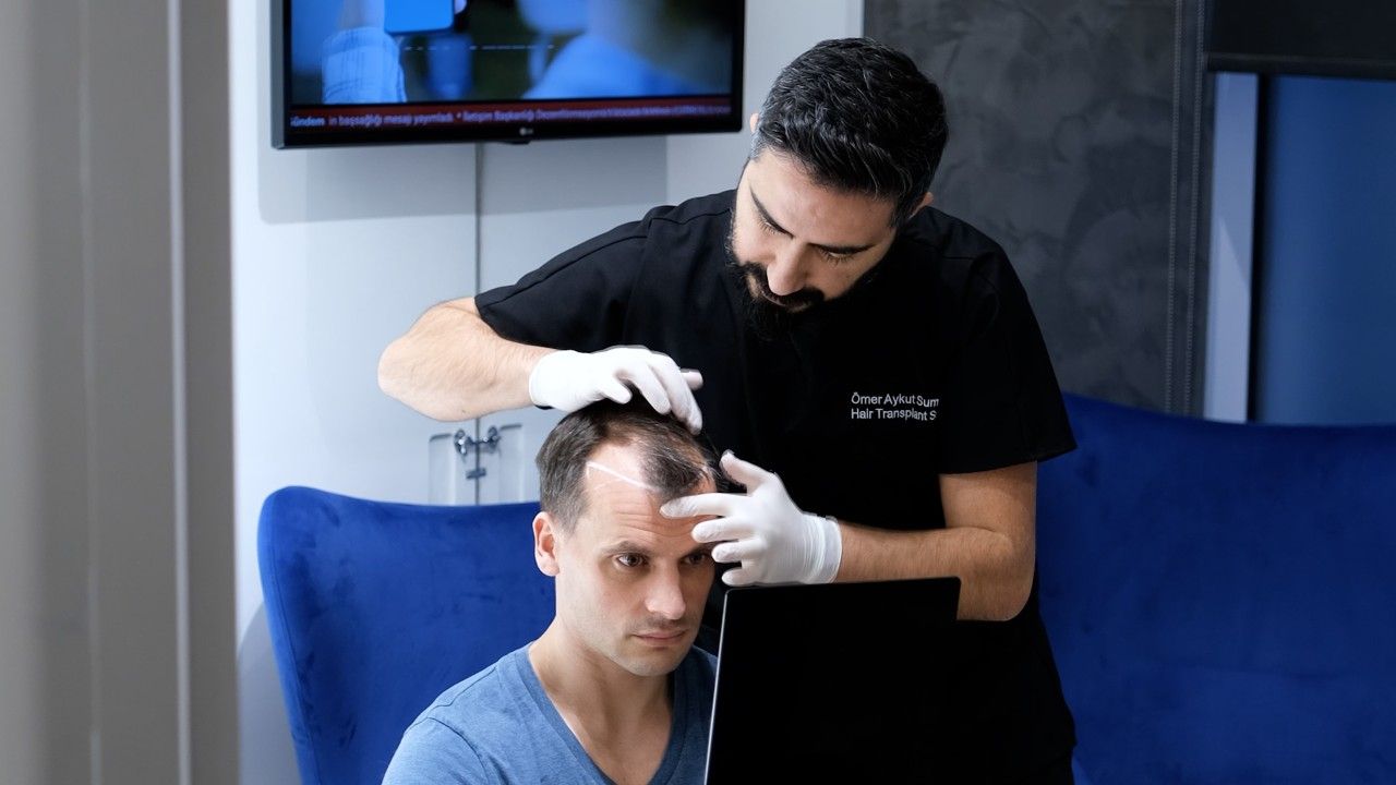 5 causas fundamentales de la pérdida de cabello y sus tratamientos