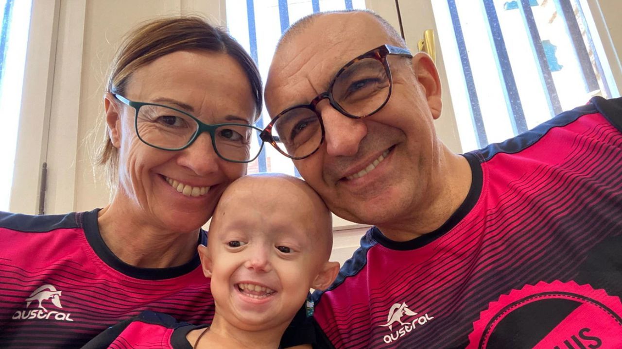 Alexandra, la única niña de España con el síndrome que acelera el ...