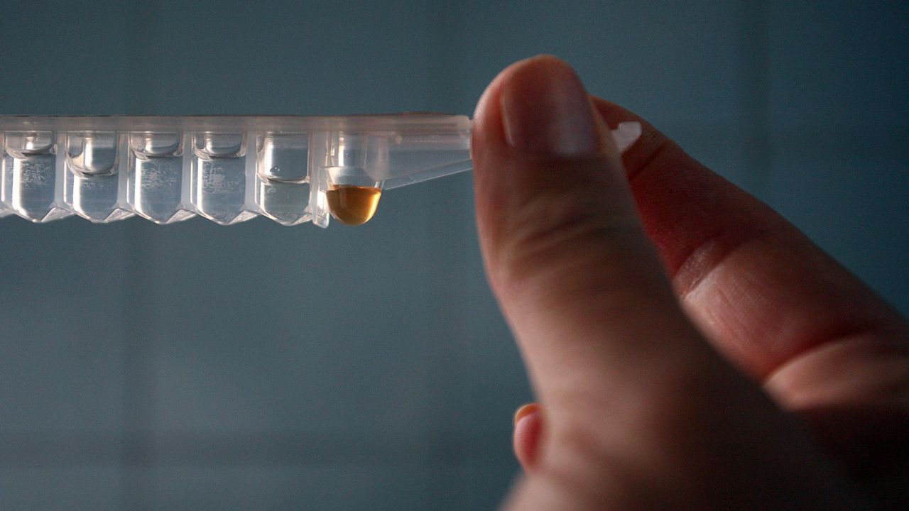 Un virus defectuoso heredado ofrece protección contra el desarrollo del VIH
